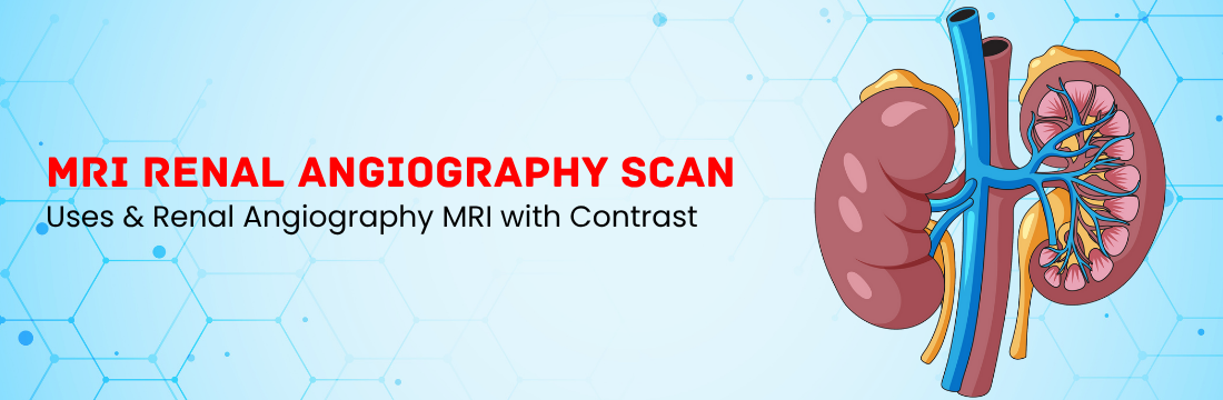 MRI Renal Angiography Scan and Its Uses | Ganesh Diagnostic
