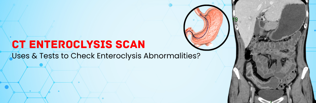 CT Enteroclysis and Its Uses