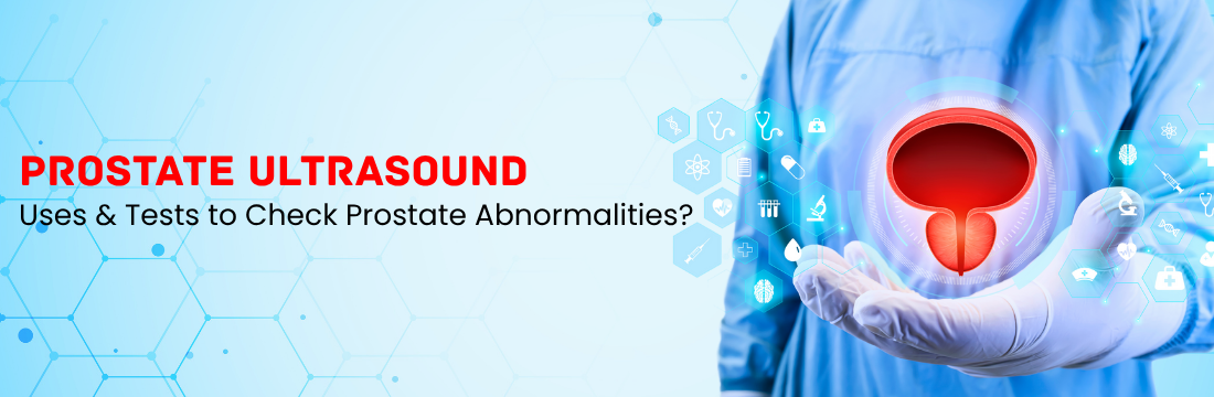 Prostate Ultrasound: Its Uses