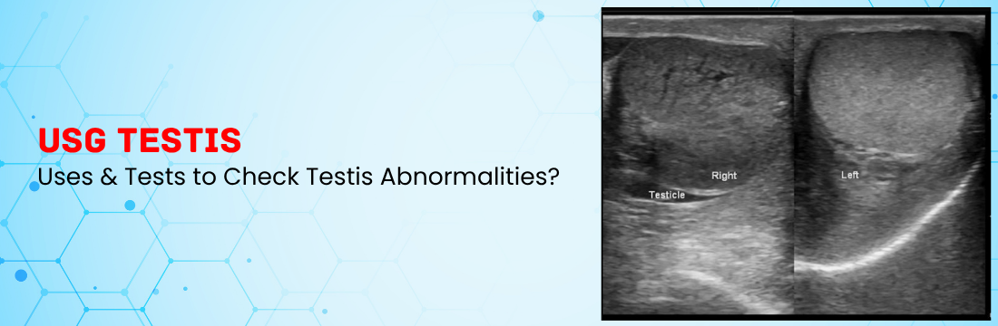 What Are the Uses of USG TESTIS?