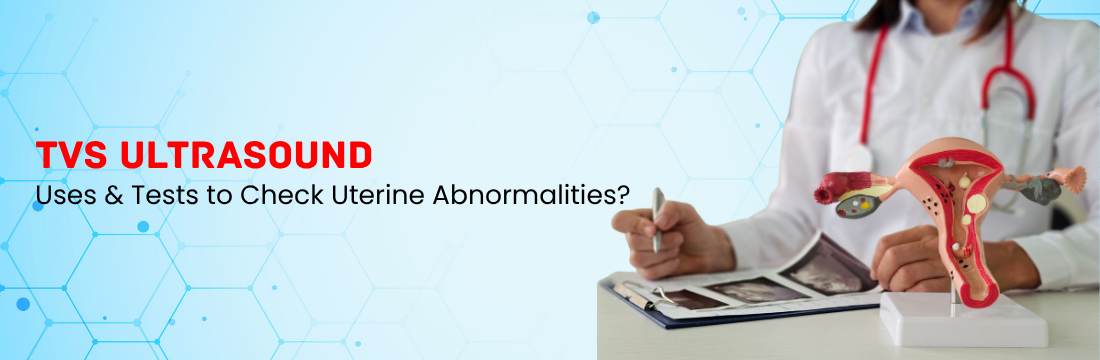 What is TVS Ultrasound and Its Purpose