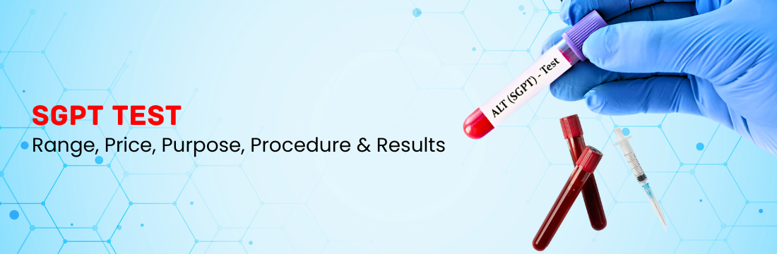 What is SGPT Test: Normal Range, Price, Purpose, Procedure & Results