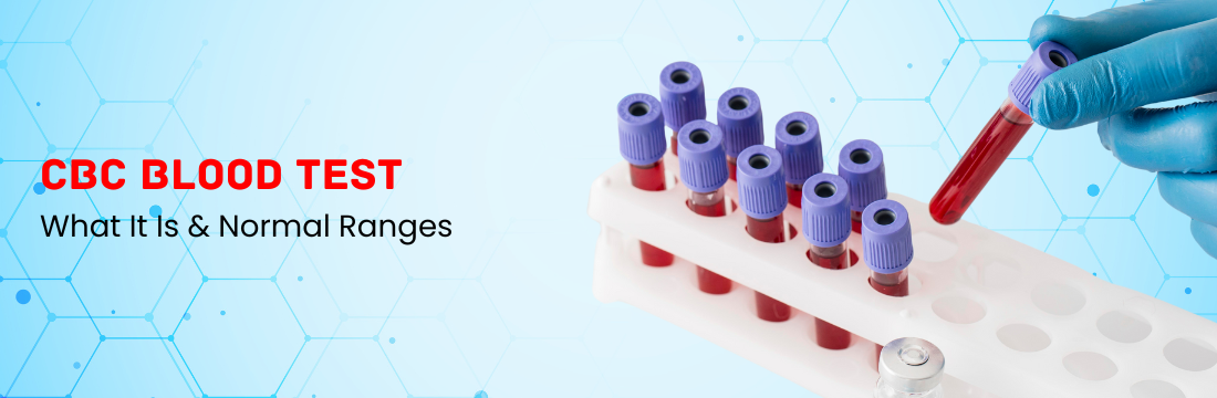 Complete Blood Count (CBC) Test: What It Is & Normal Ranges