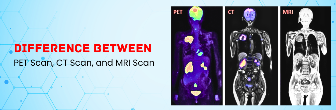 PNS CT Scan and Its Uses | Ganesh Diagnostic