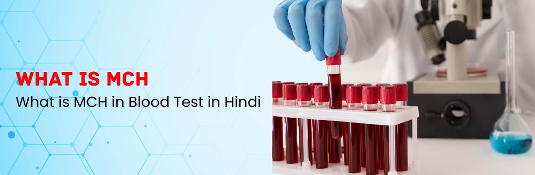 What is MCH in a Blood Test in Hindi? | Causes, Symptoms & Normal Range ...