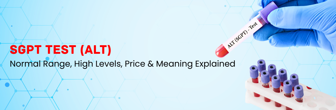 SGPT Test (ALT): Normal Range, High Levels, Price & Meaning Explained