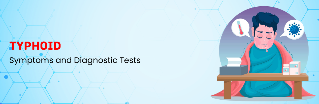 What are the Typhoid Symptoms and Diagnostic Tests?
