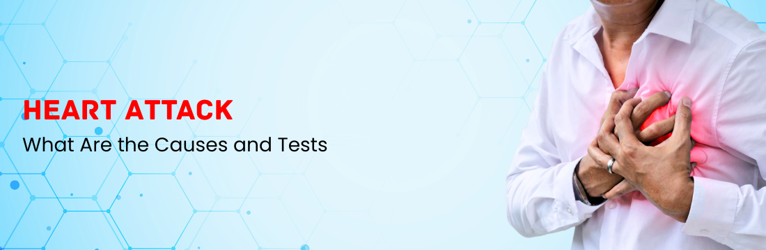 What are the Different Types or Causes of a Heart Attack