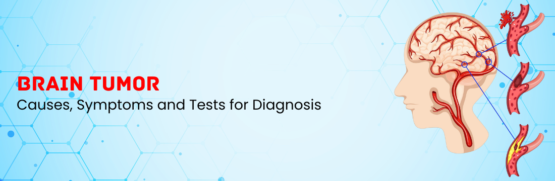 Brain Tumor Causes, Symptoms & Tests | Diagnosis Guide
