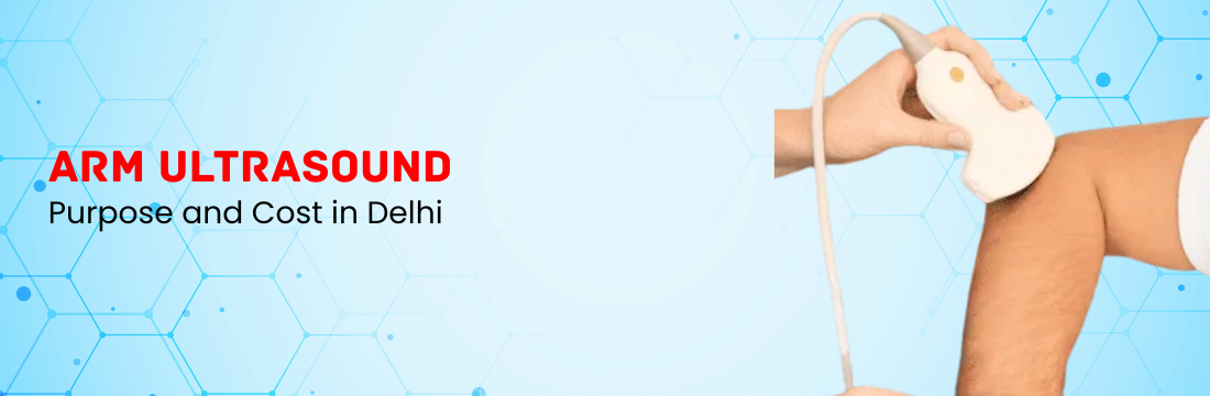 Arm Ultrasound: Purpose, Procedure & Cost in Delhi