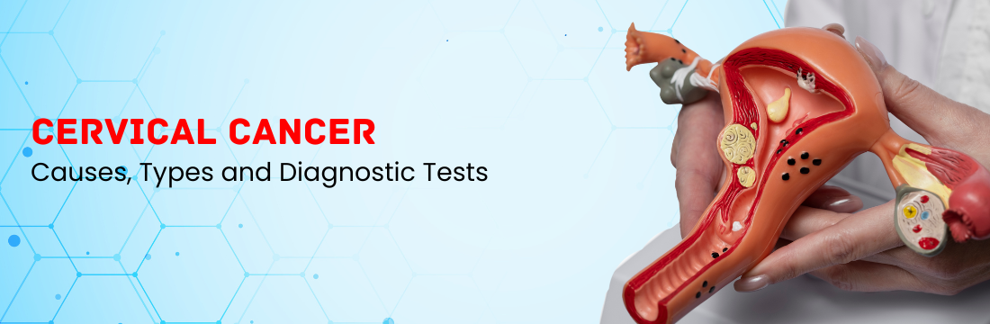 Cervical Cancer: Causes, Types & Best Diagnostic Tests | Complete Guide
