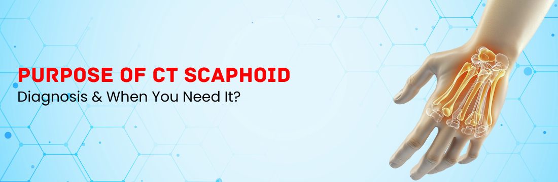Purpose of CT Scaphoid: Diagnosis & When You Need It|Ganesh Diagnostic