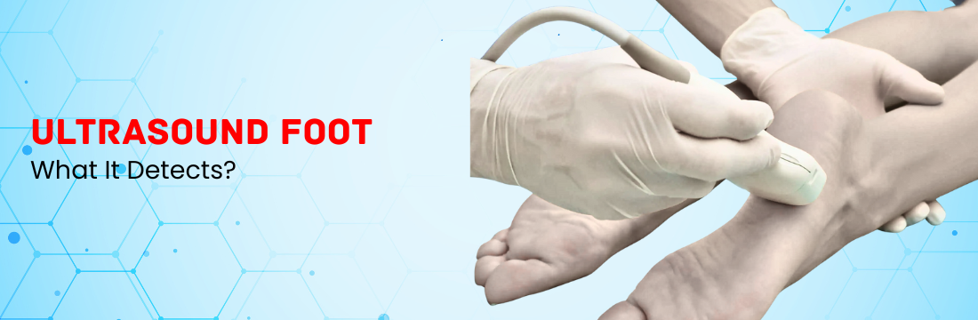 Complete Detailed: What is an Ultrasound Foot and What It Detects?