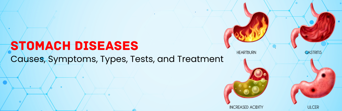 Common Stomach Diseases: Causes, Symptoms and Treatment