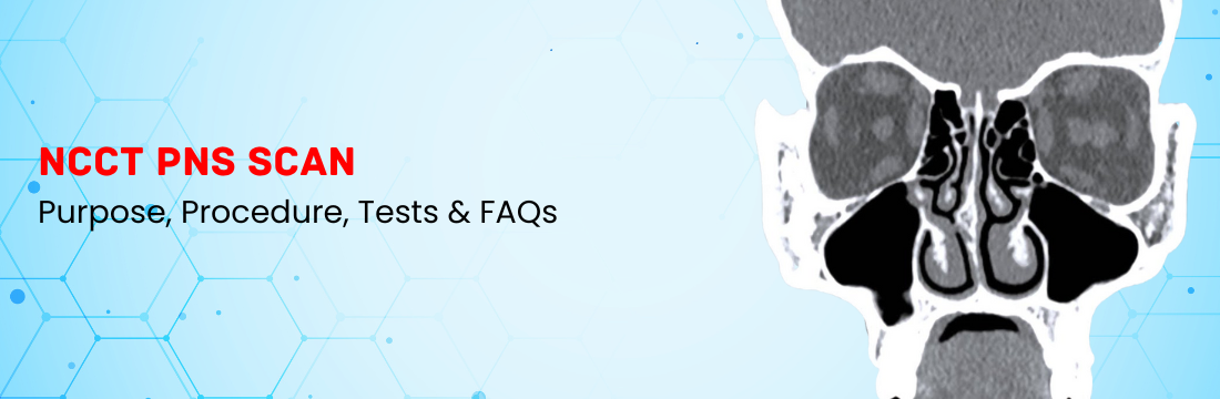 NCCT PNS Scan: Purpose, Procedure, Tests & FAQs | Ganesh Diagnostic