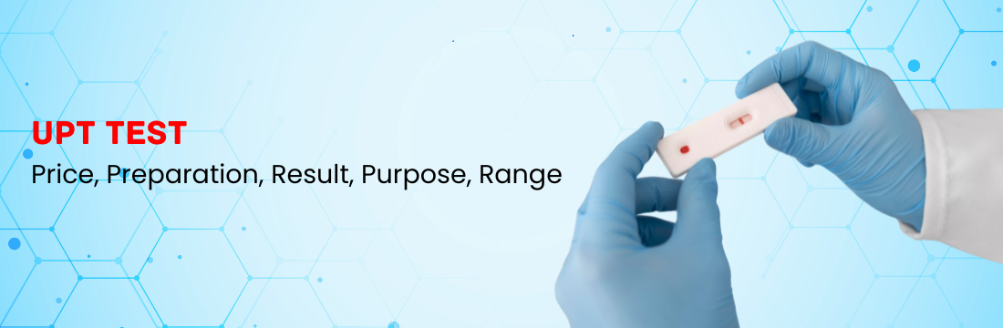 UPT Test: Price, Preparation, Purpose, Result & Range | Ganesh Diagnostic