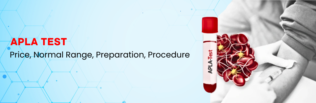 APLA Test: Price, Normal Range, and Procedure | Ganesh Diagnostic