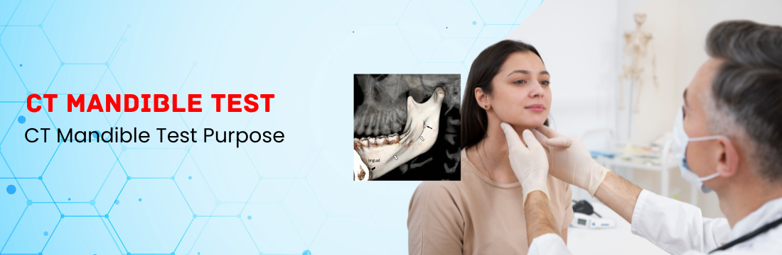 Explain the CT Mandible: Causes, Test, and Its Purpose