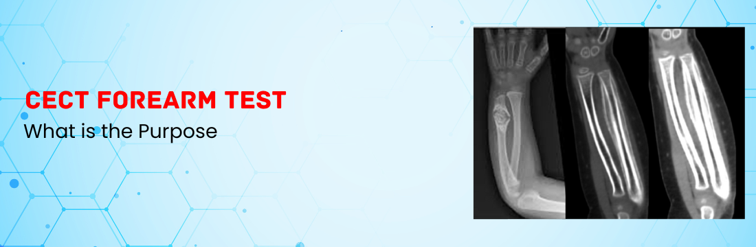 CECT Forearm Scan – Purpose, Price & Common Questions Answered