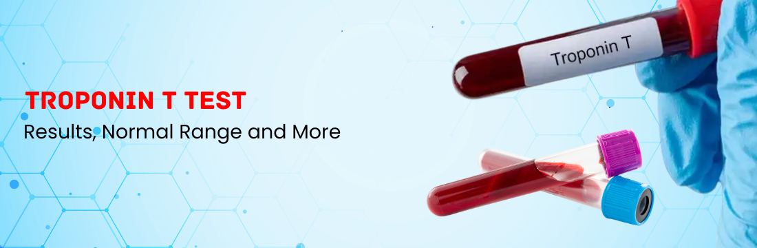 Troponin T Test: Normal Range, Positive Results & Price in India