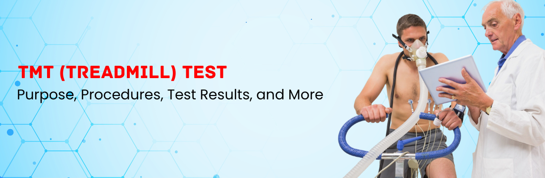 TMT Test: Treadmill Purpose, Procedures, and Test Results