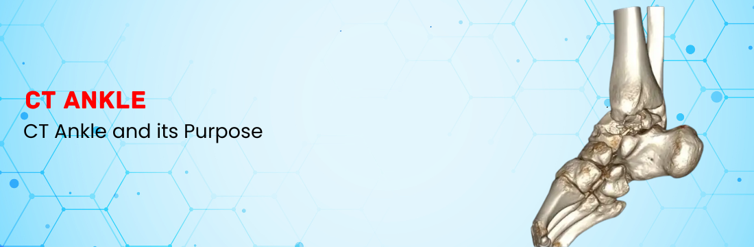 Detailed CT Ankle Scan and its Purpose | Ganesh Diagnostic