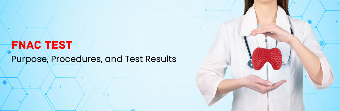 FNAC Test: Purpose, Procedures, and Test Results | Ganesh Diagnostic