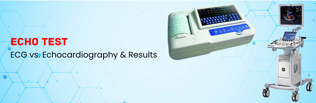 Echo Test vs ECG: Purpose, Price & What Your Heart Test Results Mean