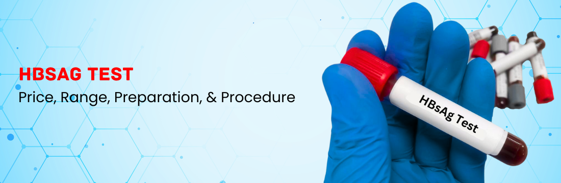 APLA Test: Price, Normal Range, and Procedure | Ganesh Diagnostic