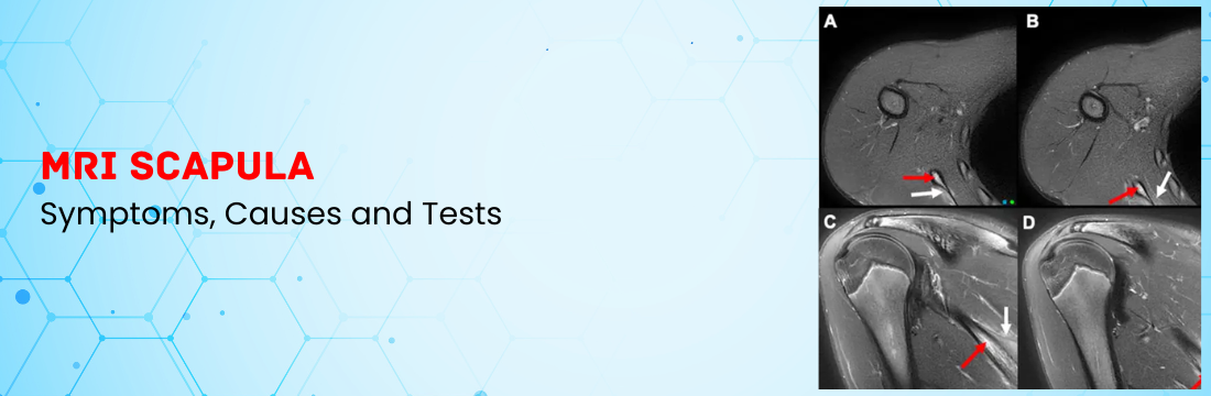 Purpose of MRI Scapula | Symptoms of Scapula Abnormalities