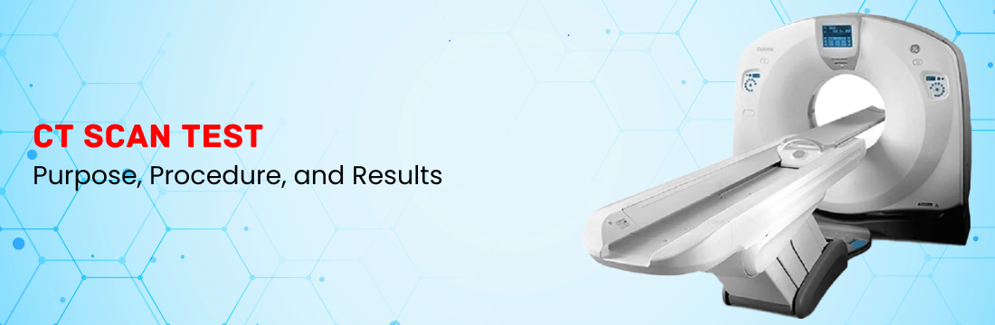 CT scan Test - Purpose, Procedure, and Results