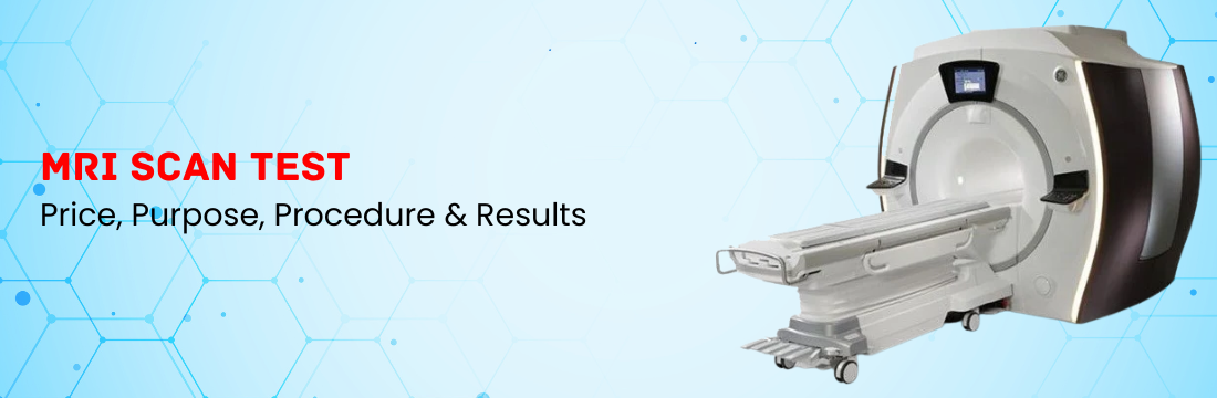 MRI Scan Test - Price, Purpose, Procedure & Results