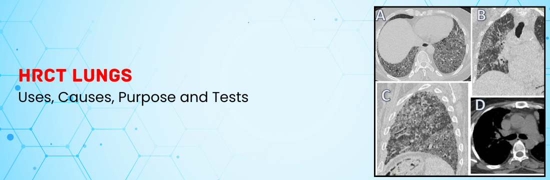PCV Test Guide: Importance, Range & Process