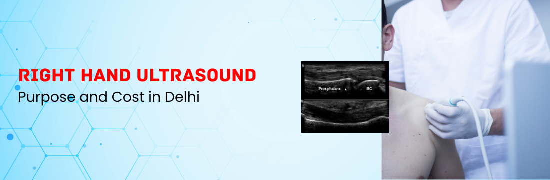 Right Hand Ultrasound: Purpose, Procedure & Test in Delhi