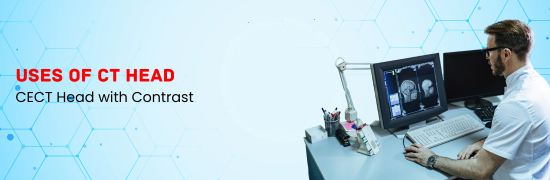 NCCT PNS Scan: Purpose, Procedure, Tests & FAQs | Ganesh Diagnostic