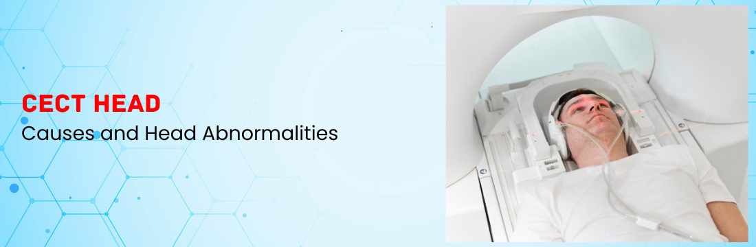 CECT Head for Head Abnormalities & Causes | Ganesh Diagnostic