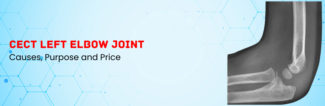 CECT Left Elbow Joint and Its Price in Delhi