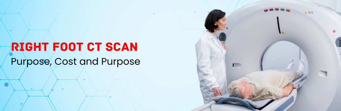 CT scan Test - Purpose, Procedure, and Results