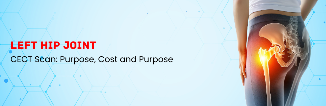 Left Hip Joint CECT Scan: Purpose, Cost and Purpose