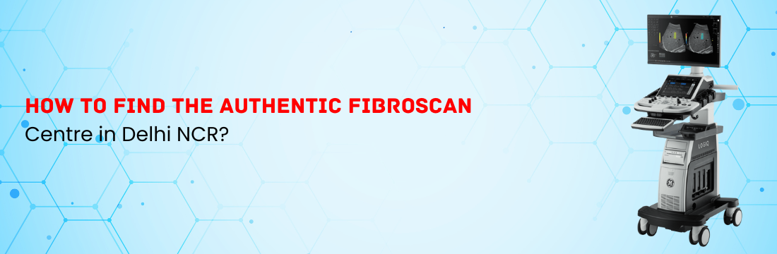 How to Find the Authentic FibroScan Test Centre in Delhi NCR