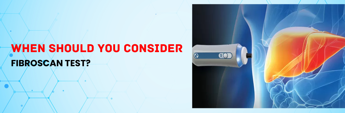 When Should You Consider a FibroScan Test? | Ganesh Diagnostic