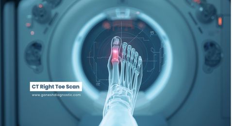 CT Right Toe Scan: Purpose & Cost in Delhi NCR