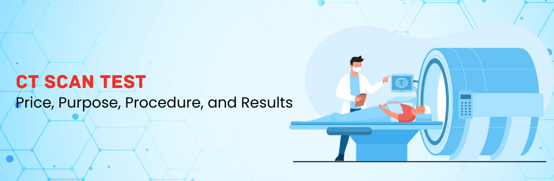 CT Scan Test – Price, Purpose, Procedure, and Results