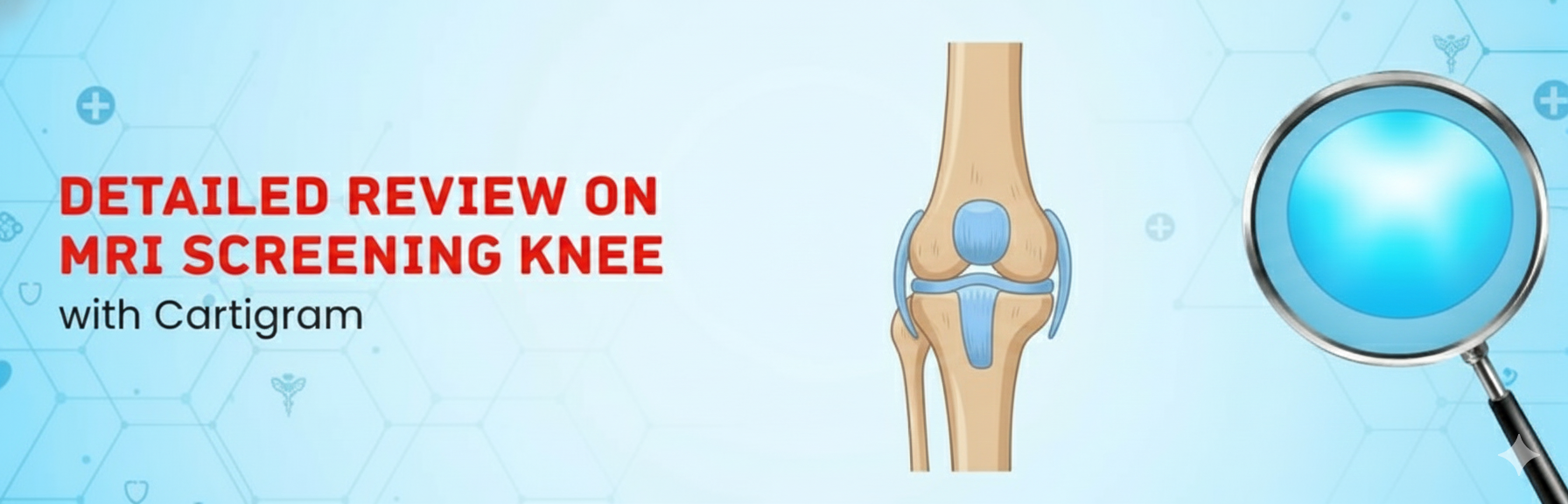MRI Screening Knee with Cartigram: A Detailed Review