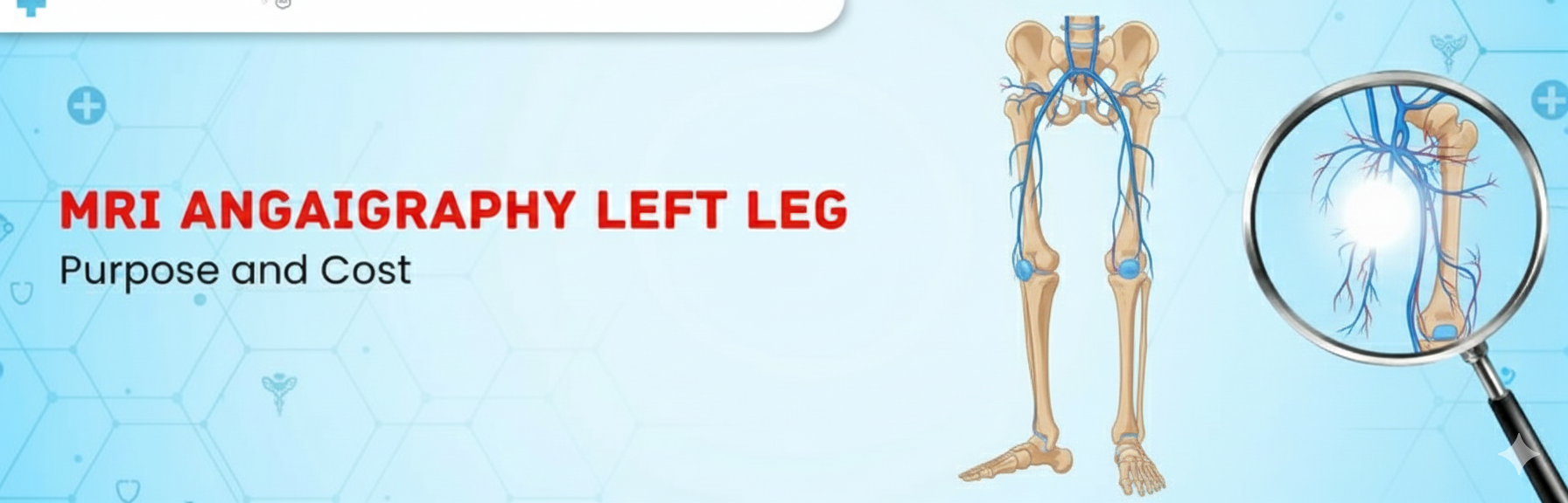 MRI Angiography Left leg: Purpose and Cost