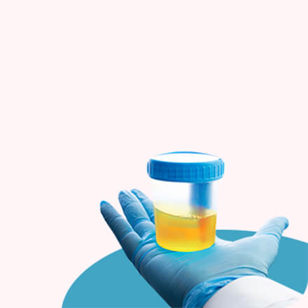 24 HRS URINE COPPER (ATOMIC ABSORPTION)