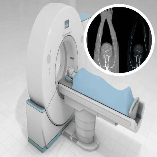 CT Angiography Upper Limb - Test Price in Delhi | Ganesh Diagnostic