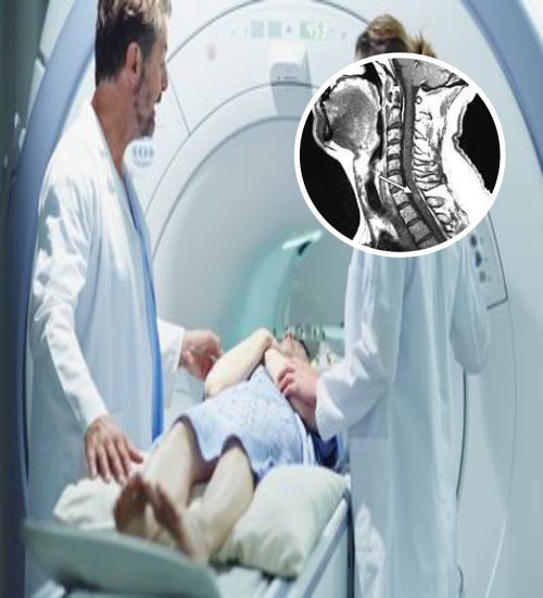 MRI Multiple Sclerosis Protocol Test Near You in Delhi | Book Test at ...