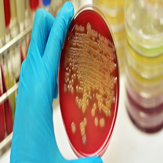 Stool Culture and Sensitivity | Test Price In Delhi, India | Ganesh ...