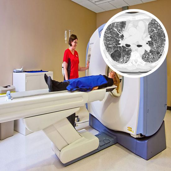 HRCT Lungs | Test Price in Delhi | Ganesh Diagnostics